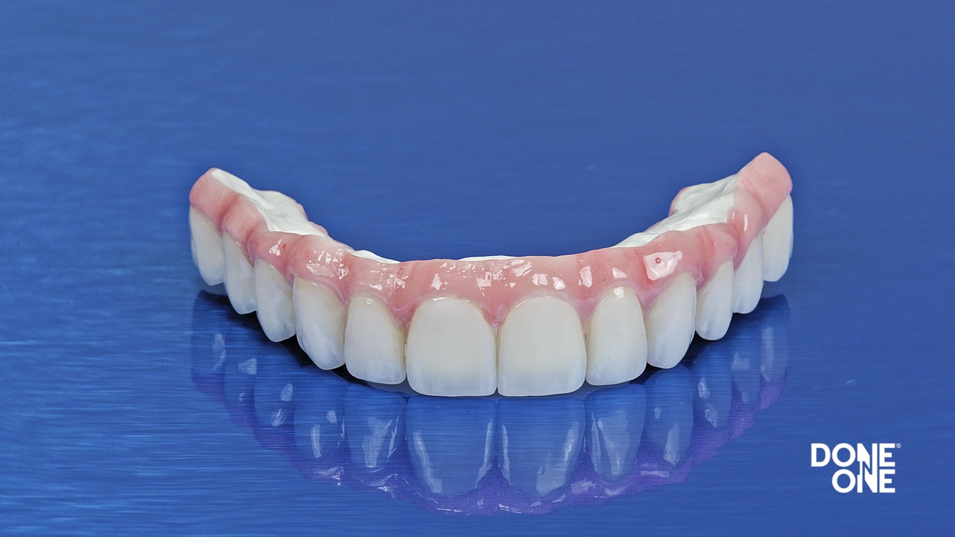 Questionnaire - Done In One - Permanent Implant Teeth in One Week